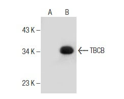 Anti-TBCB Antibody (B-12) | SCBT - Santa Cruz Biotechnology