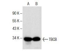 TBCB Antibody (B-12) | SCBT - Santa Cruz Biotechnology