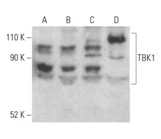 TBK1 Antibody (A-6) | SCBT - Santa Cruz Biotechnology