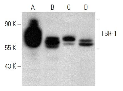 TBR-1 Antibody (G-5) | SCBT - Santa Cruz Biotechnology