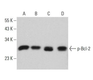 p-Bcl-2 (662.Ser 70): sc-293129. Western blot analysis of...