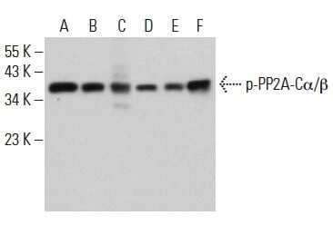 TBS Blotto B | SCBT - Santa Cruz Biotechnology