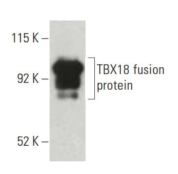 Anti-TBX18 Antibody (CD-21) | SCBT - Santa Cruz Biotechnology