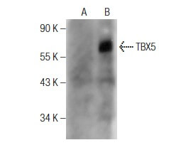 Anti-TBX5 Antibody (A-4) | SCBT - Santa Cruz Biotechnology