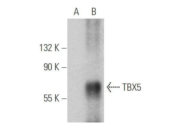 TBX5 Antibody (A-6) | SCBT - Santa Cruz Biotechnology