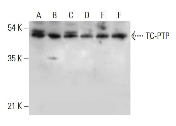 TC-PTP Antibody (D-3) | SCBT - Santa Cruz Biotechnology
