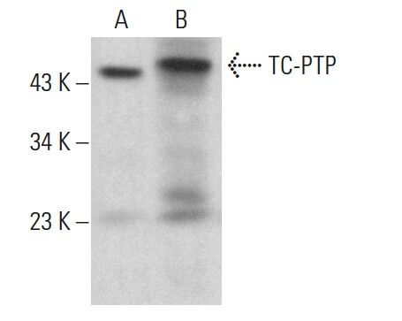 TC-PTP Antibody (E-11) | SCBT - Santa Cruz Biotechnology