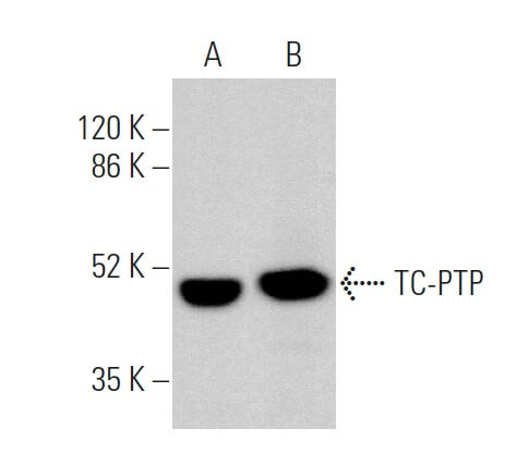 TC-PTP Antibody (F-8) | SCBT - Santa Cruz Biotechnology