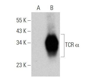 Anti-TCR α Antibody (H-1) | SCBT - Santa Cruz Biotechnology
