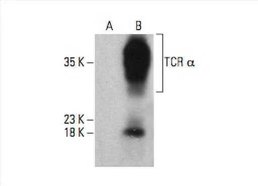 Anti-TCR α Antibody (H-1) | SCBT - Santa Cruz Biotechnology
