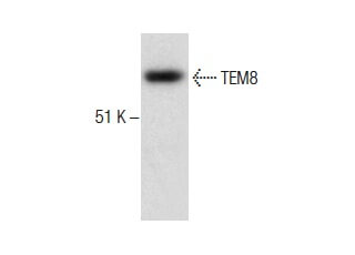 Anti-TEM8 Antibody (4H261) | SCBT - Santa Cruz Biotechnology