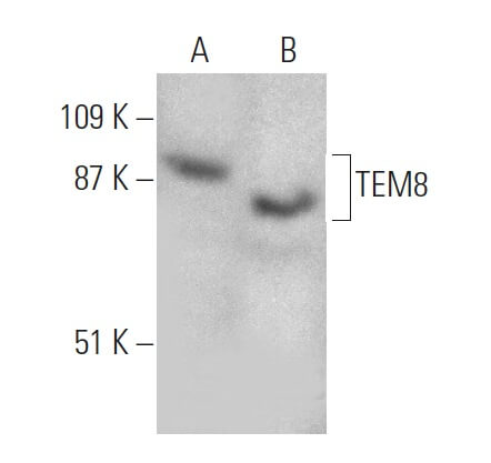 TEM8 Antibody (4H261) | SCBT - Santa Cruz Biotechnology