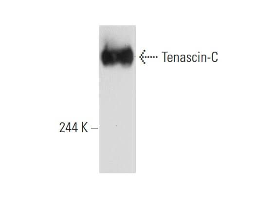 Tenascin-C抗体 (300-3) | SCBT - Santa Cruz Biotechnology