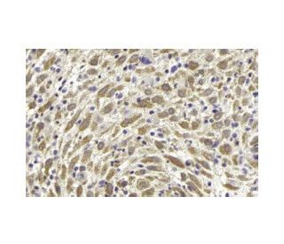 Tenascin-C Antibody (E-9) - Immunohistochemistry - Image 13285