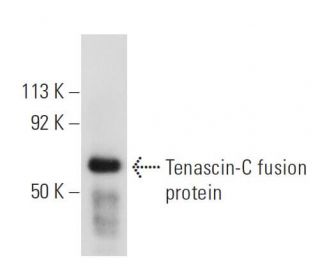 Tenascin-C Antibody (E-9) | SCBT - Santa Cruz Biotechnology