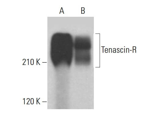 Anti-Tenascin-R Antibody (A-2) | SCBT - Santa Cruz Biotechnology