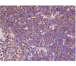 TERT Antibody (A-6) - Immunohistochemistry - Image 356362