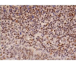TERT Antibody (A-6) - Immunohistochemistry - Image 357524