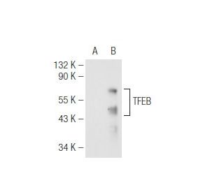 TFEB Antibody (C-6) - Western Blotting - Image 93668