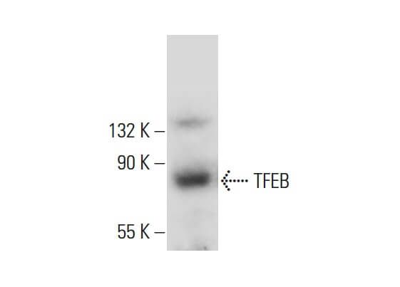 TFEB Antibody (C-6) | SCBT - Santa Cruz Biotechnology