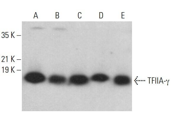 TFIIA-γ Antibody (D-6) | SCBT - Santa Cruz Biotechnology
