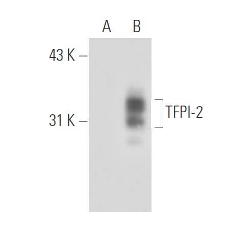 Anti-TFPI-2 Antibody (B-7) | SCBT - Santa Cruz Biotechnology