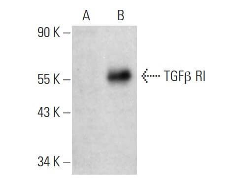 TGF beta Receptor 1/TGFBR1 Antibody (D-1) | SCBT - Santa Cruz Biotechnology