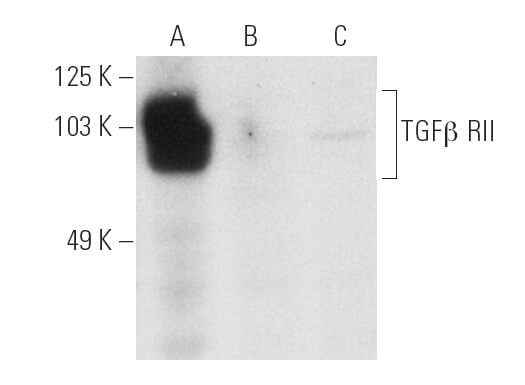 TGFβ Receptor II/TGFBR2 Antibody (D-2) | SCBT - Santa Cruz Biotechnology