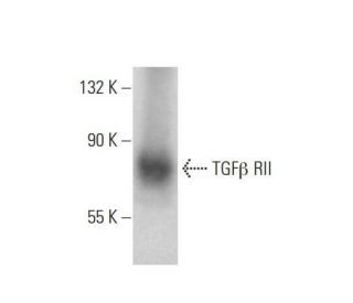 TGFβ Receptor II/TGFBR2 Antibody (D-2) | SCBT - Santa Cruz Biotechnology