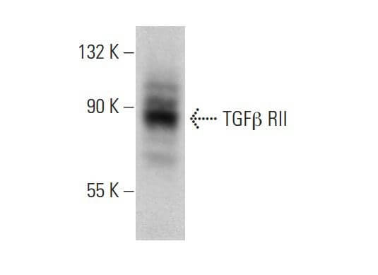 TGFβ Receptor II/TGFBR2 Antibody (D-2) | SCBT - Santa Cruz Biotechnology