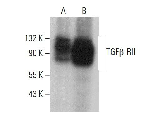 TGF beta Receptor 2/TGFBR2抗体 (D-2) | SCBT - Santa Cruz Biotechnology