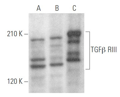 Anti-TGFβ RIII Antibody (A-4) | SCBT - Santa Cruz Biotechnology