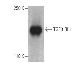 TGFβ RIII Antibody (A-4) | SCBT - Santa Cruz Biotechnology