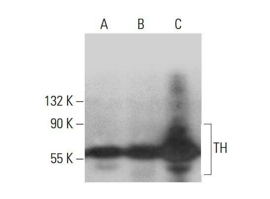 TH Antibody (H-196) | SCBT - Santa Cruz Biotechnology