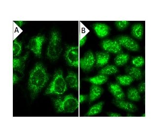 Thapsigargin: sc-24017. Immunofluorescence staining of methanol-fixed ...
