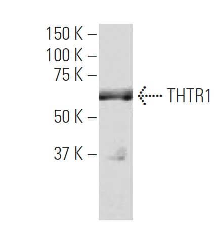 THTR1 Antibody (R-5) | SCBT - Santa Cruz Biotechnology