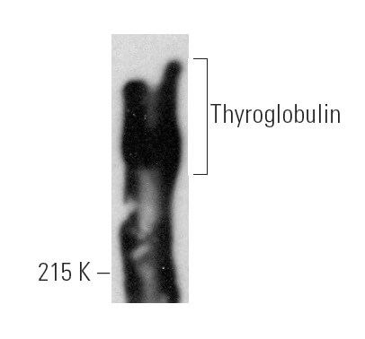 Anti-Thyroglobulin Antibody (D-9) | SCBT - Santa Cruz Biotechnology