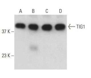TIG1 Antibody (G-2) - Western Blotting - Image 398101