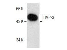 TIMP-3抗体 (B-2) | SCBT - Santa Cruz Biotechnology
