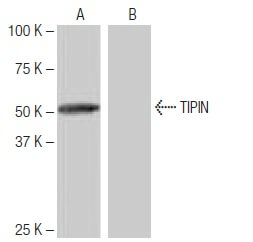 TIPIN Antibody (4C9) | SCBT - Santa Cruz Biotechnology