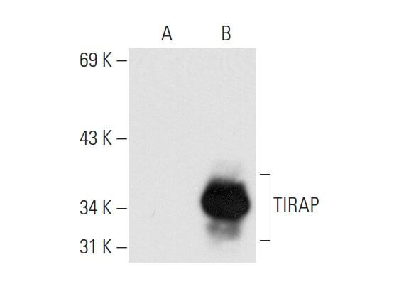 TIRAP Antibody (A-11) | SCBT - Santa Cruz Biotechnology