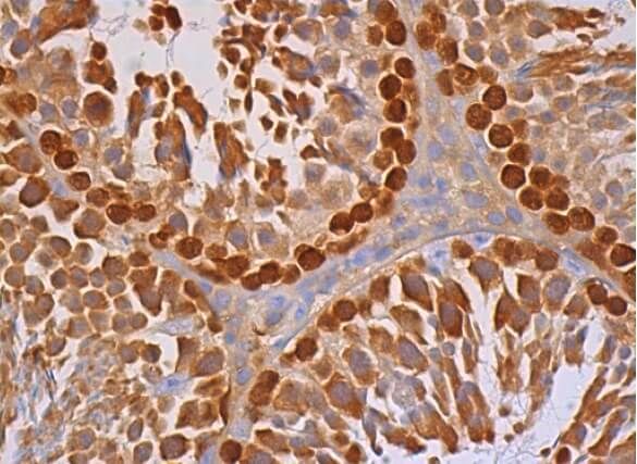 TKTL1/2 Antibody (E-8) | SCBT - Santa Cruz Biotechnology