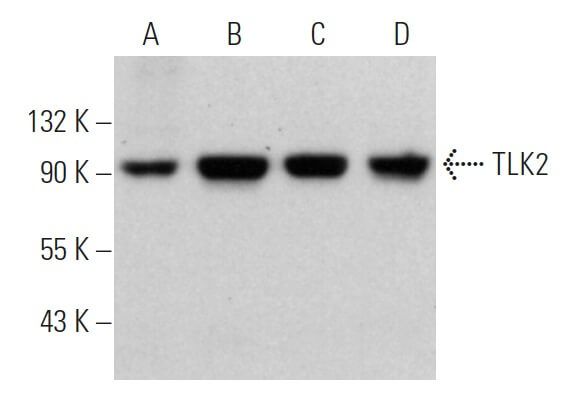 TLK2 Antibody (E-12) | SCBT - Santa Cruz Biotechnology