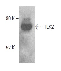 Anti-TLK2 Antibody (E-12) | SCBT - Santa Cruz Biotechnology