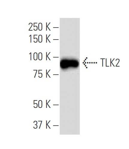 TLK2 Antibody (Y-17) | SCBT - Santa Cruz Biotechnology