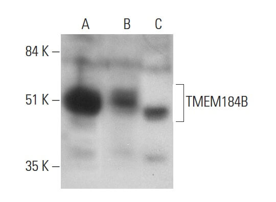 Anti-TMEM184B Antibody (A-6) | SCBT - Santa Cruz Biotechnology