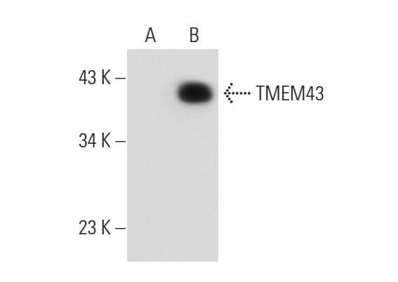 Anti-TMEM43 Antibody (F-3) | SCBT - Santa Cruz Biotechnology