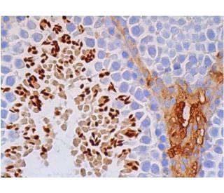 Anti-TNP2 Antibody (B-2) | SCBT - Santa Cruz Biotechnology