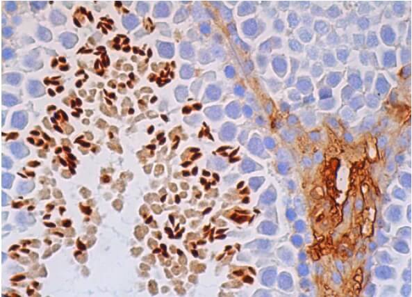 Anti-TNP2 Antibody (B-2) | SCBT - Santa Cruz Biotechnology