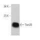 Anti-Tom20 Antibody (F-10) | SCBT - Santa Cruz Biotechnology